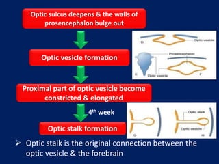 Anatomy of Optic Nerve | PPTX