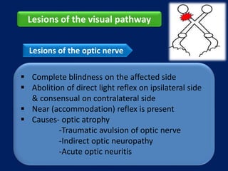 Anatomy of Optic Nerve | PPTX