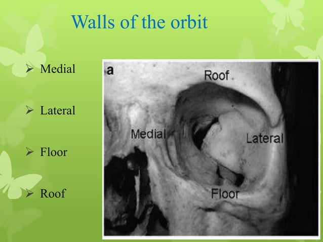 Anatomy of Eye Orbit | PPTX