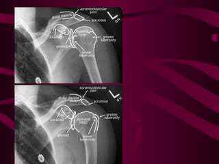 Anatomy of the arm (detailed) | PPT