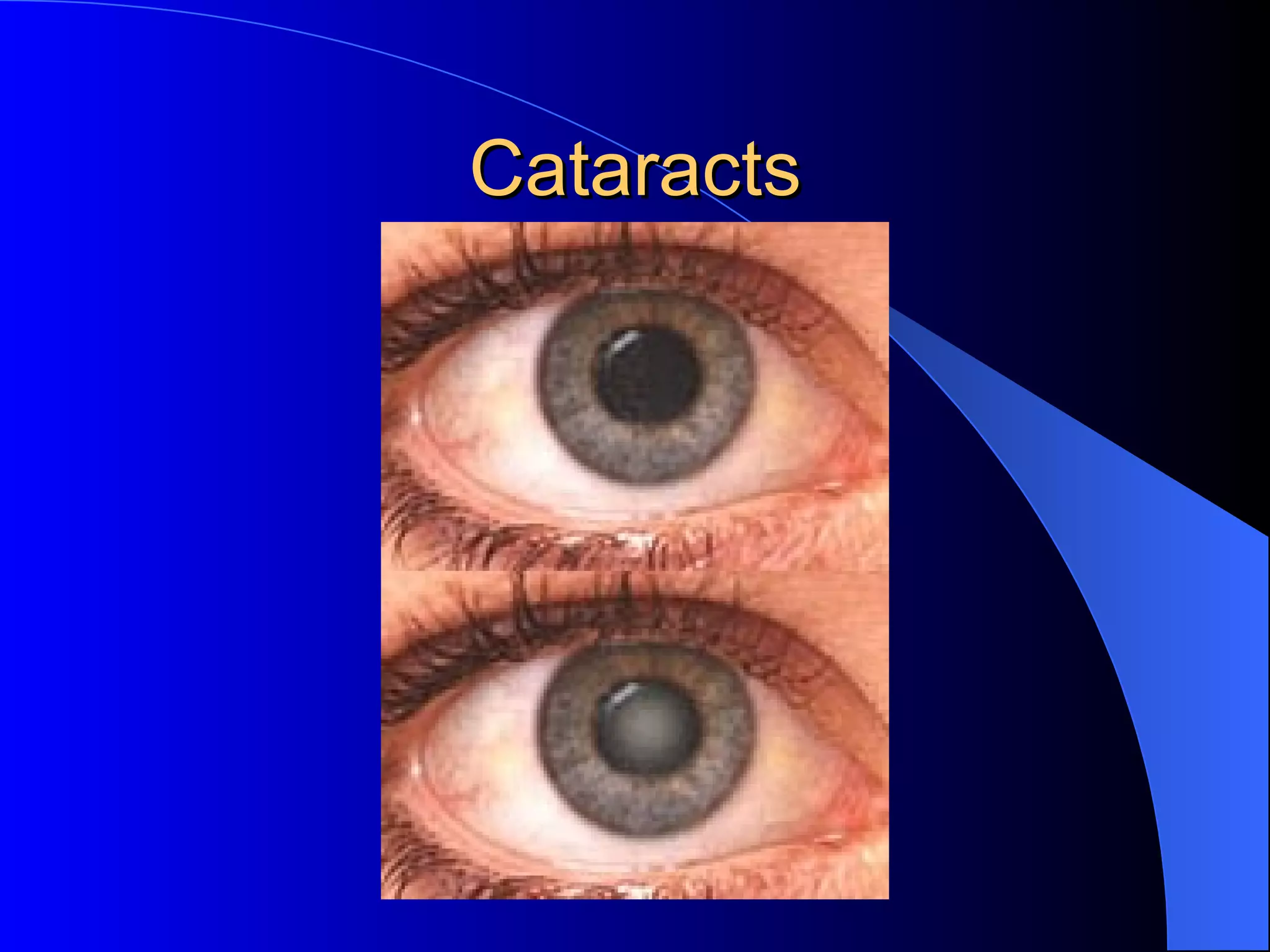 Anatomy of the Eye | PPT