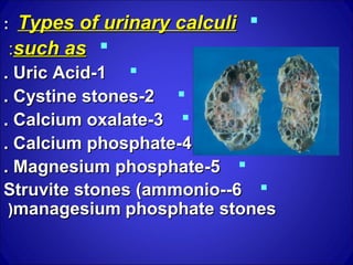 Anatomy urinary tract proplems&stons | PPT