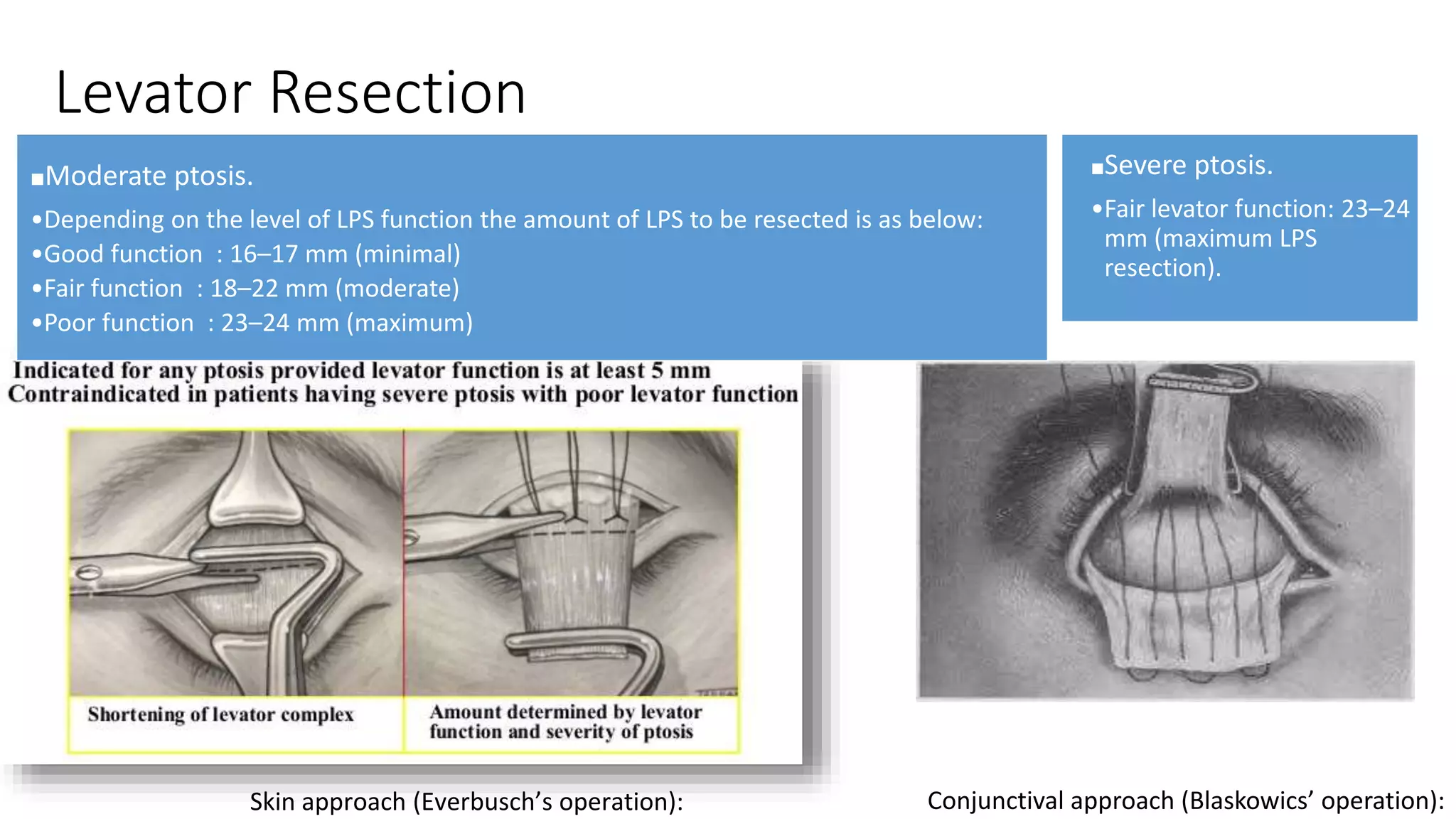 Anatomy Of Eyelid And Ptosis | PPTX