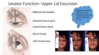 Anatomy Of Eyelid And Ptosis | PPTX
