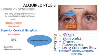 Anatomy Of Eyelid And Ptosis | PPTX