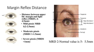 Anatomy Of Eyelid And Ptosis | PPT