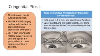 Anatomy Of Eyelid And Ptosis | PPT
