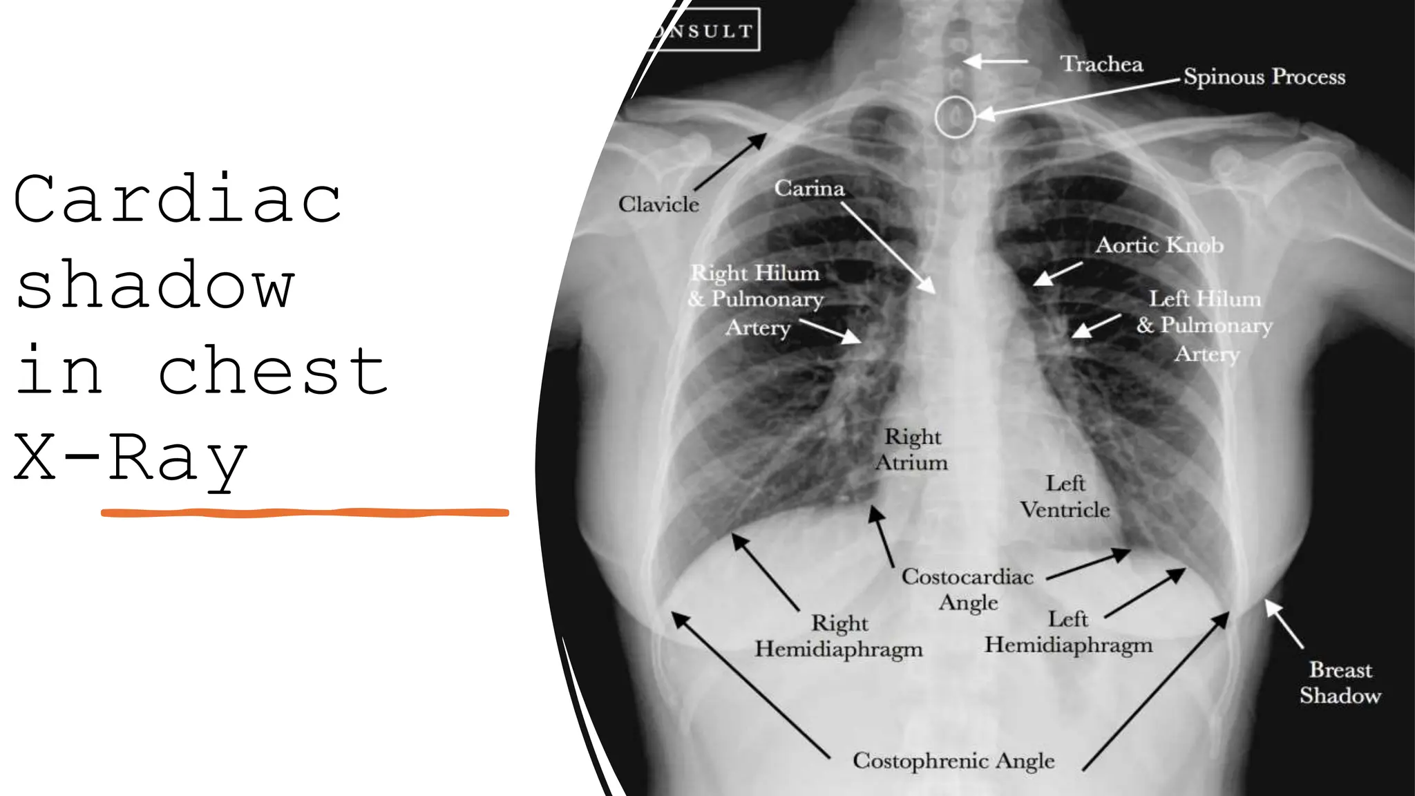 ANATOMY OF HEART - CARDIOVASCULAR SYSTEM | PPTX | Heart and ...