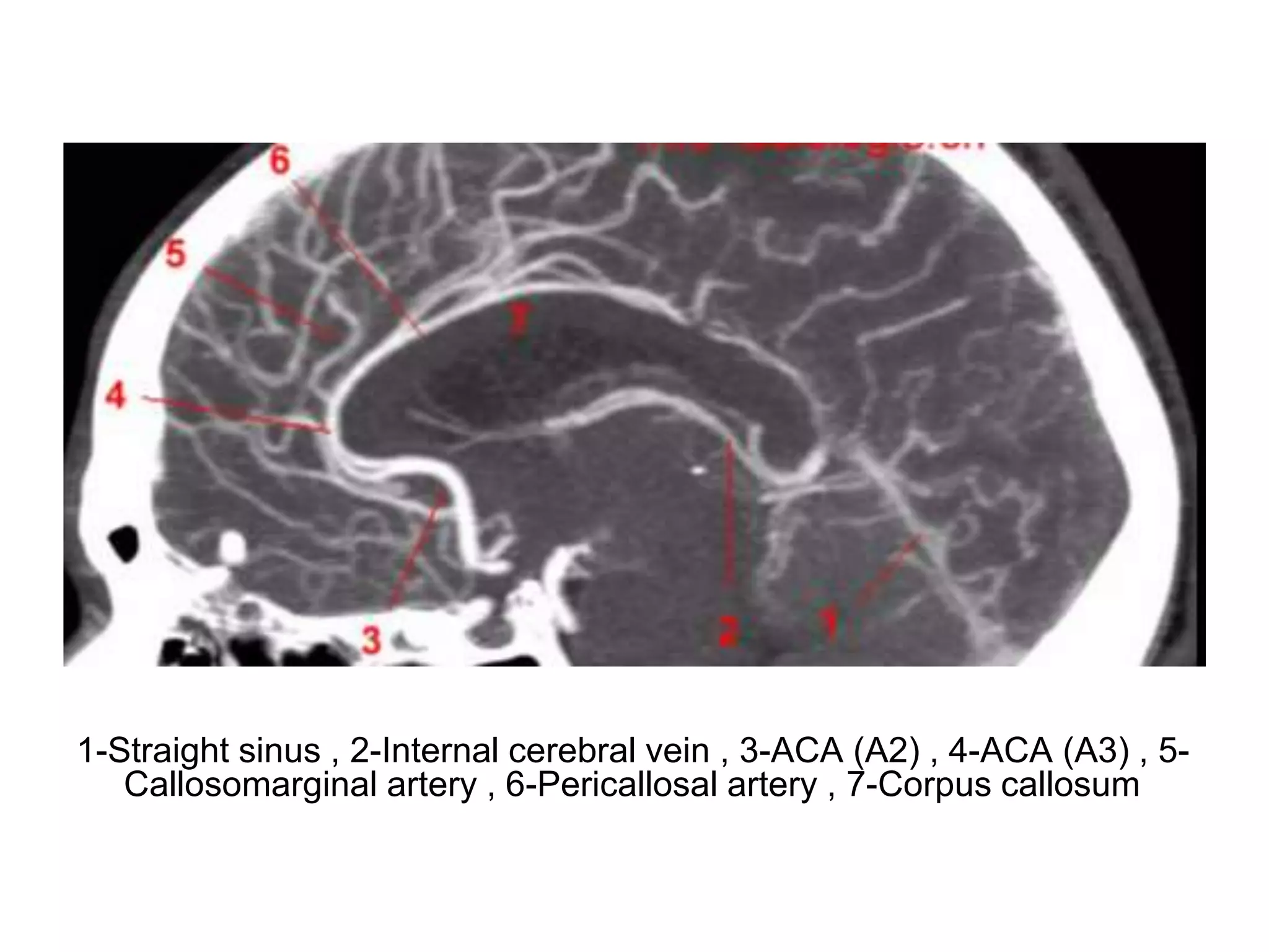Anatomy of the anterior cerebral artery (ACA) | PPT