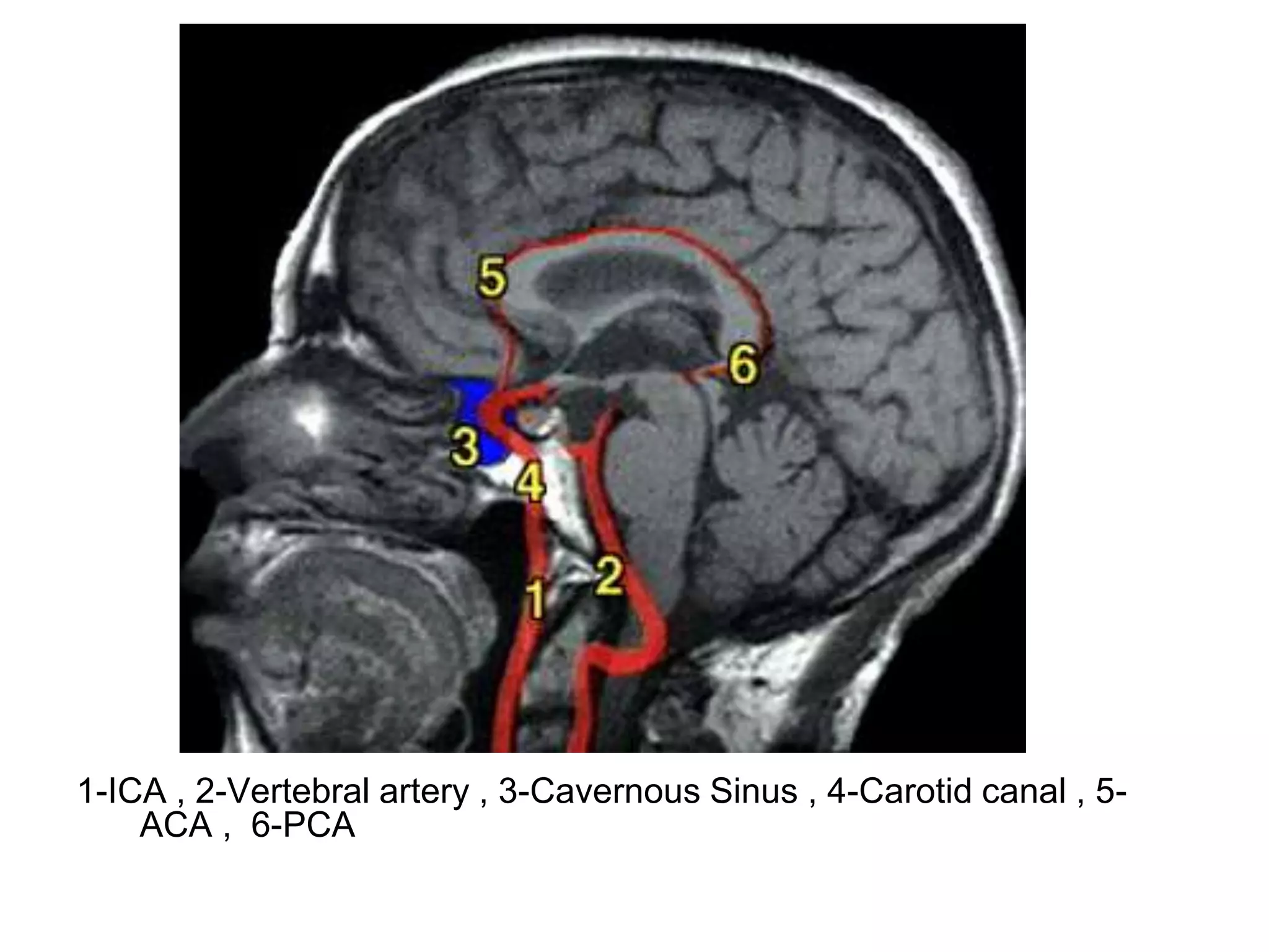 Anatomy of the anterior cerebral artery (ACA) | PPT