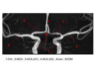 Anatomy of the anterior cerebral artery (ACA) | PPT