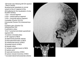 Anatomy of the anterior cerebral artery (ACA) | PPT