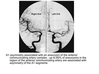 Anatomy of the anterior cerebral artery (ACA) | PPT
