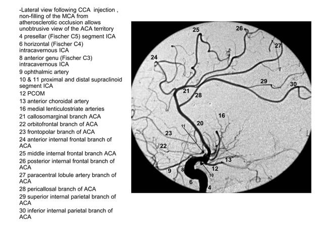 Anatomy of the anterior cerebral artery (ACA)