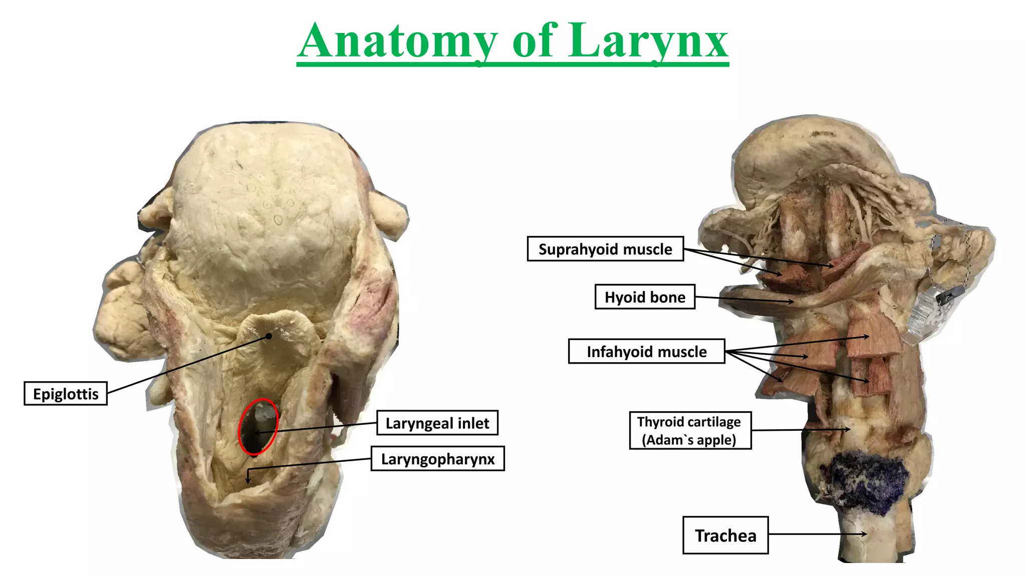 Anatomy (anatomy of air passage) | PDF
