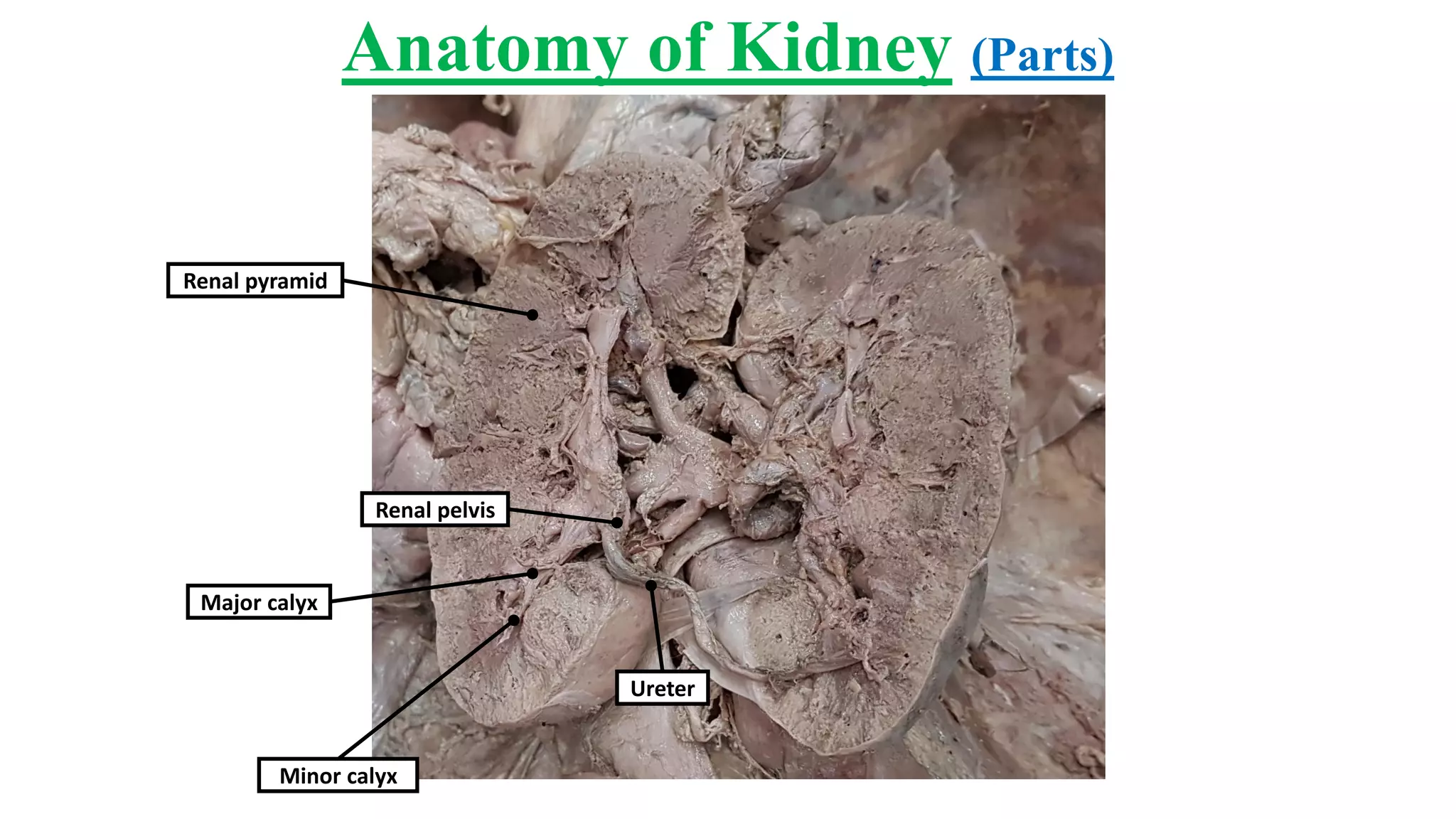 Anatomy (anatomy of upper urinary tract) | PDF