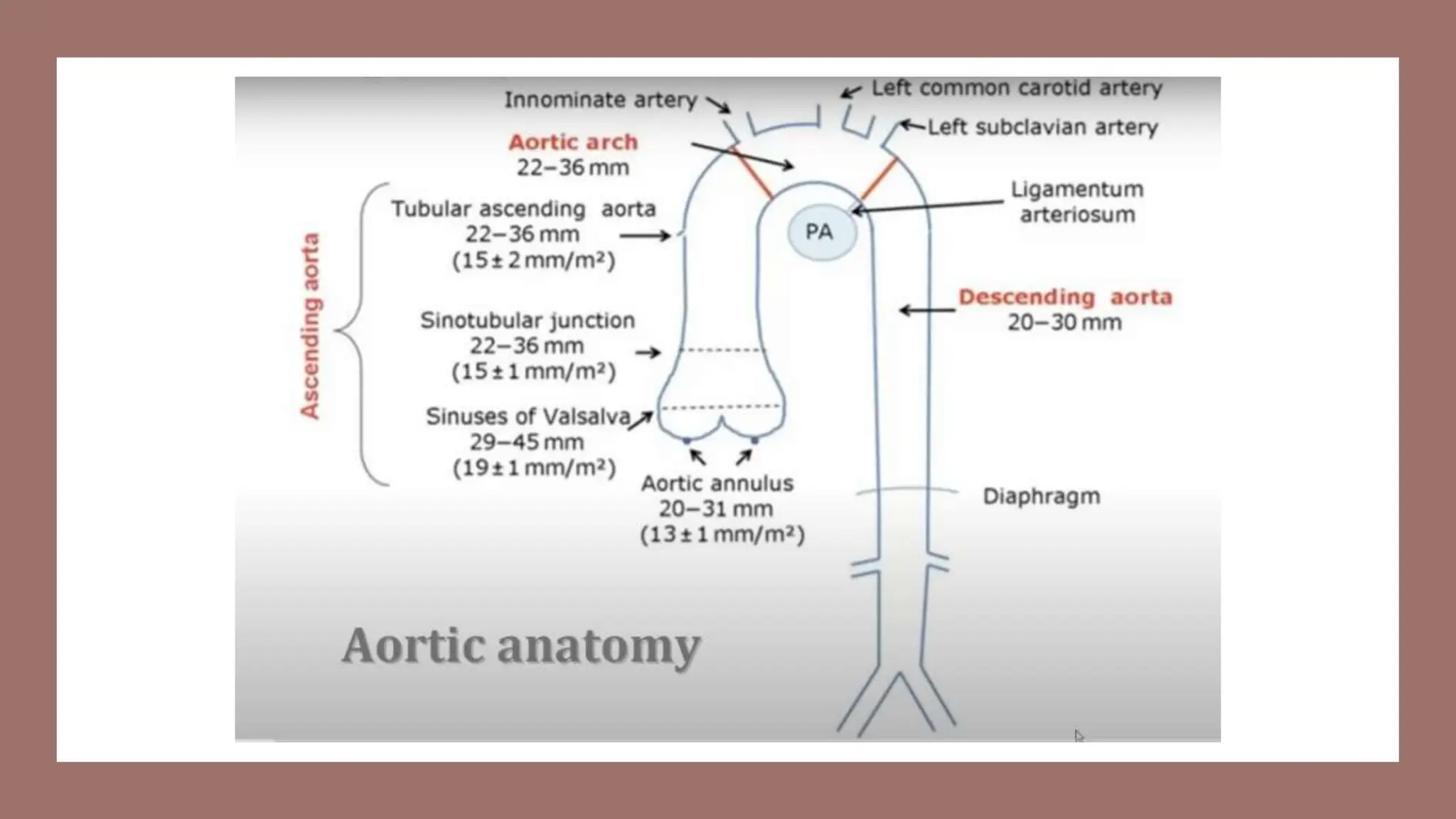 Anatomy and Anomalies of Aorta .pptx