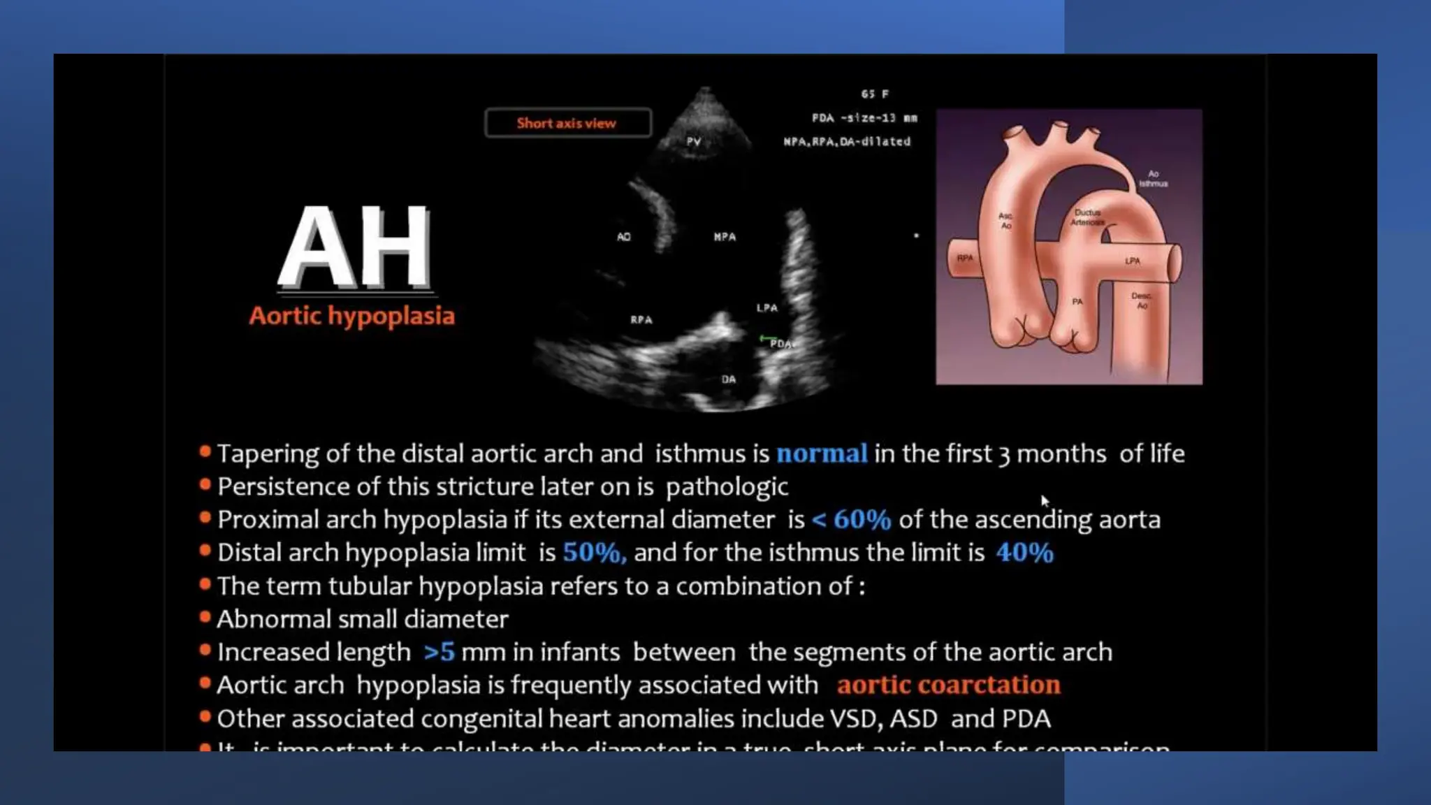 Anatomy and Anomalies of Aorta .pptx