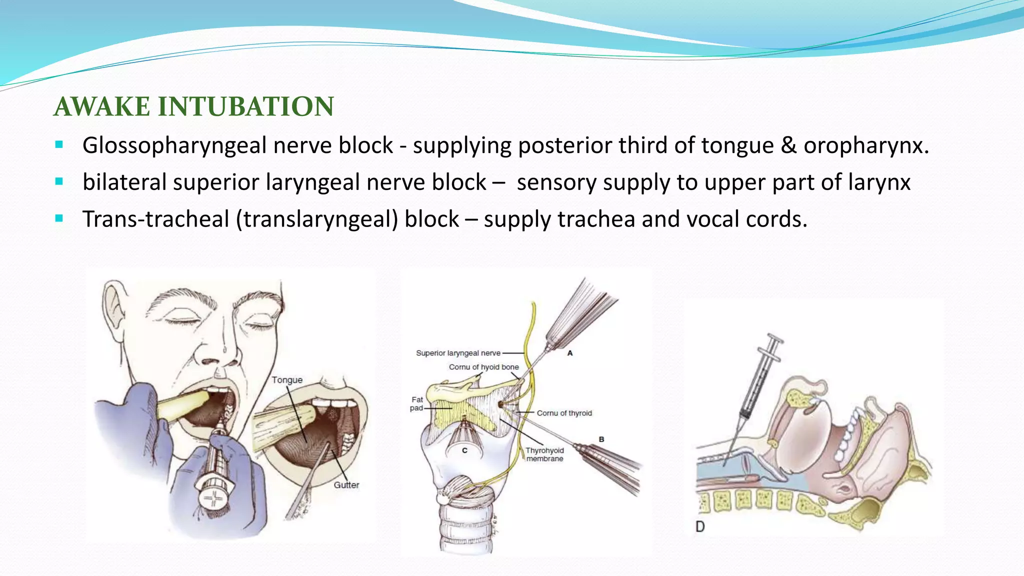 Anatomy and assessment of Airway | PPTX