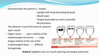 Anatomy and assessment of Airway | PPTX