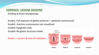 Anatomy and assessment of Airway | PPTX