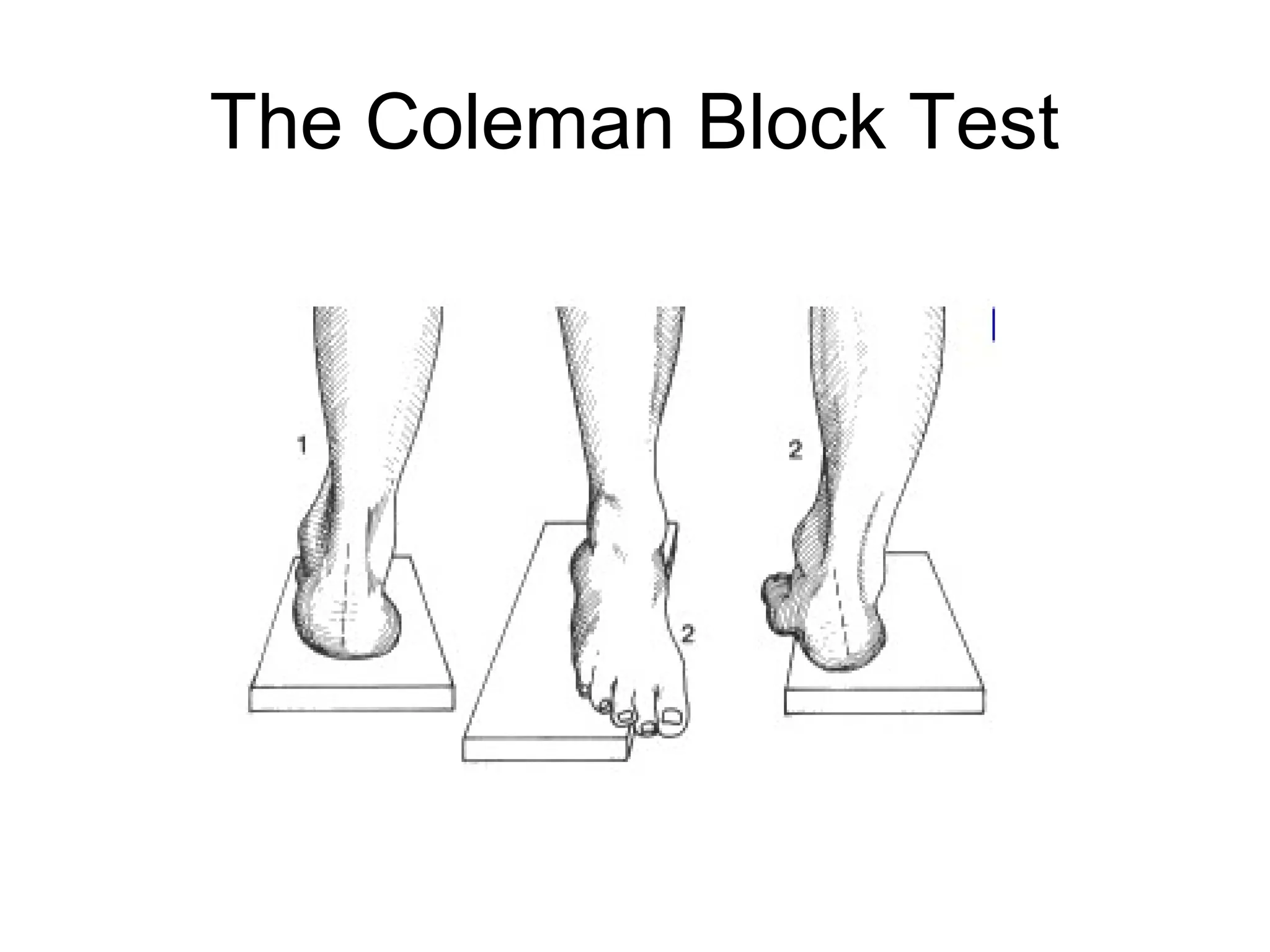 Anatomy and biomechanics of the foot and ankle - Derek Park | PPT
