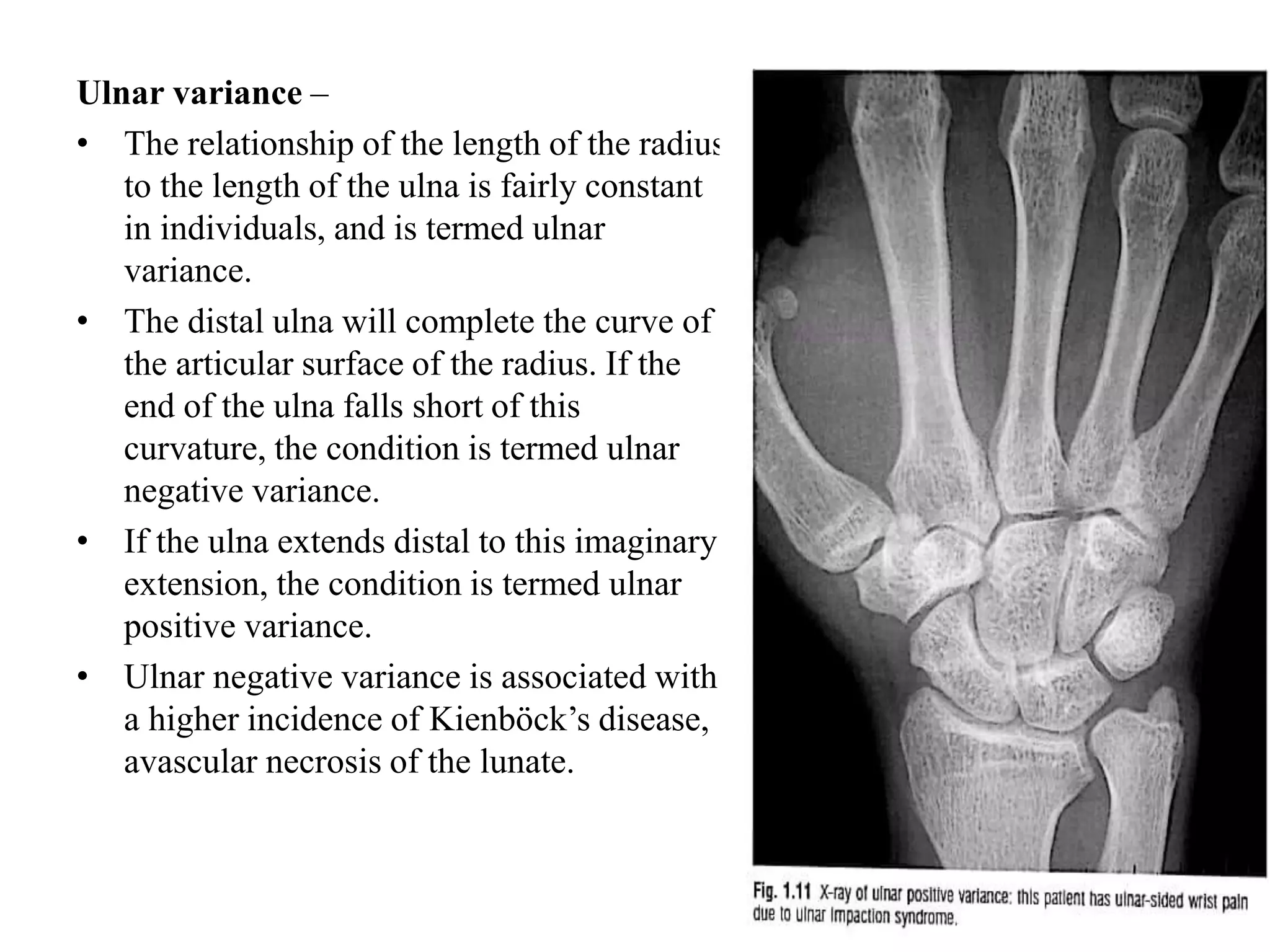 Anatomy and biomechanics of hand | PPTX