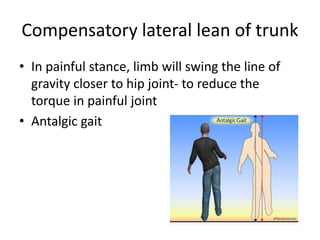 Anatomy and biomechanics of Hip joint | PPTX