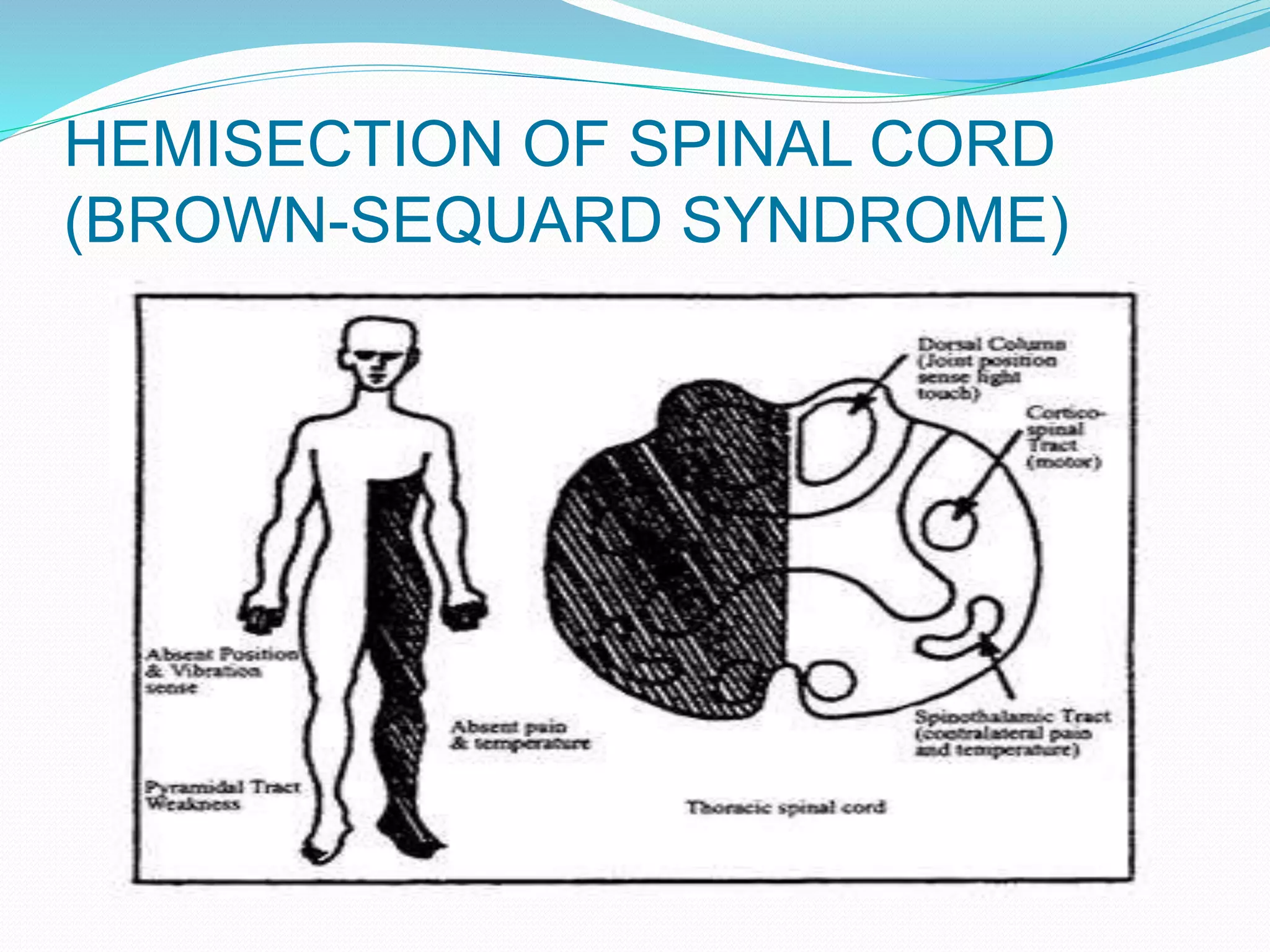 Anatomy and blood supply of spinal cord | PPTX