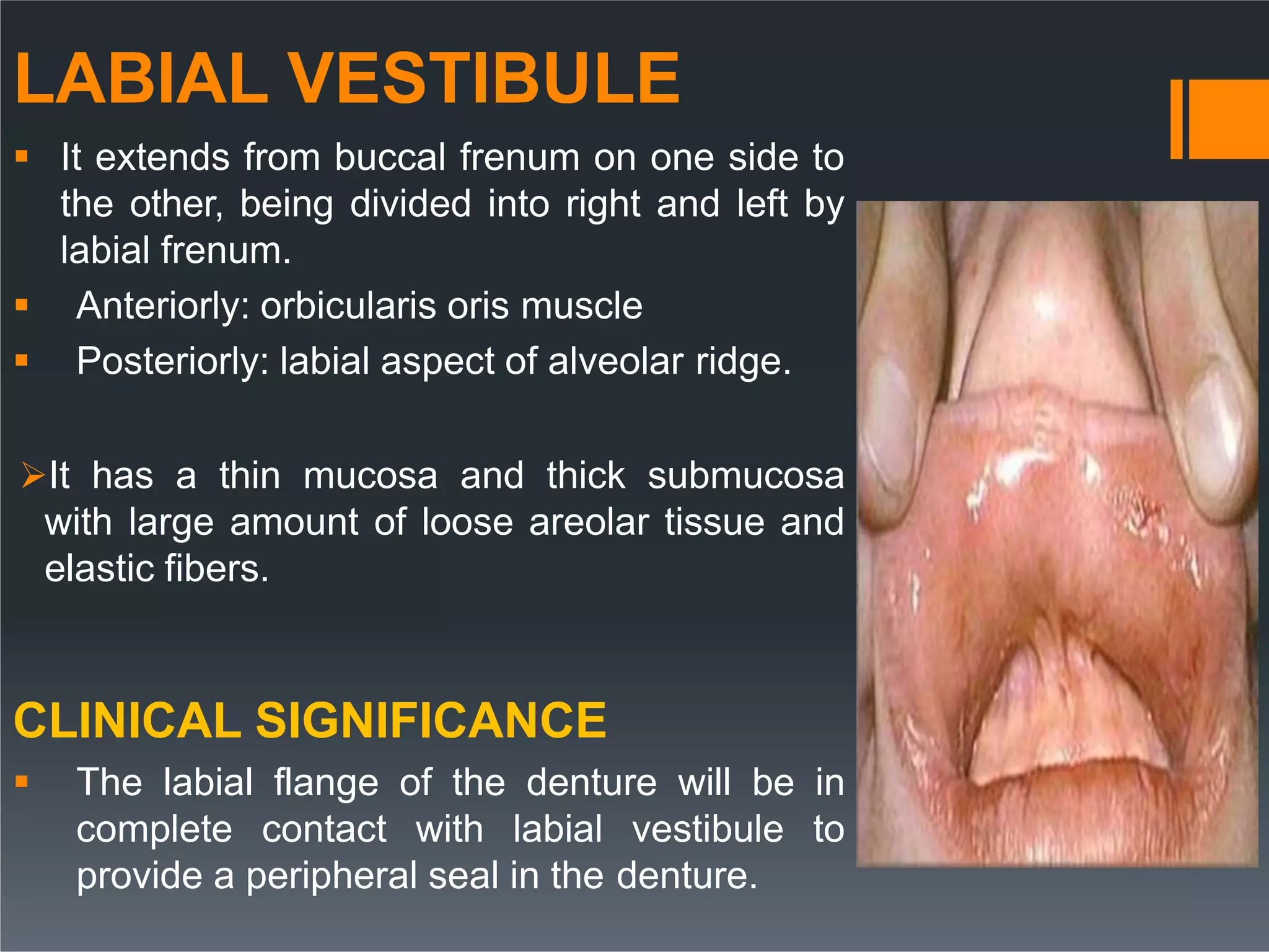 anatomyandclinicalsignificanceofdenturebearingareas-160731195726 ...