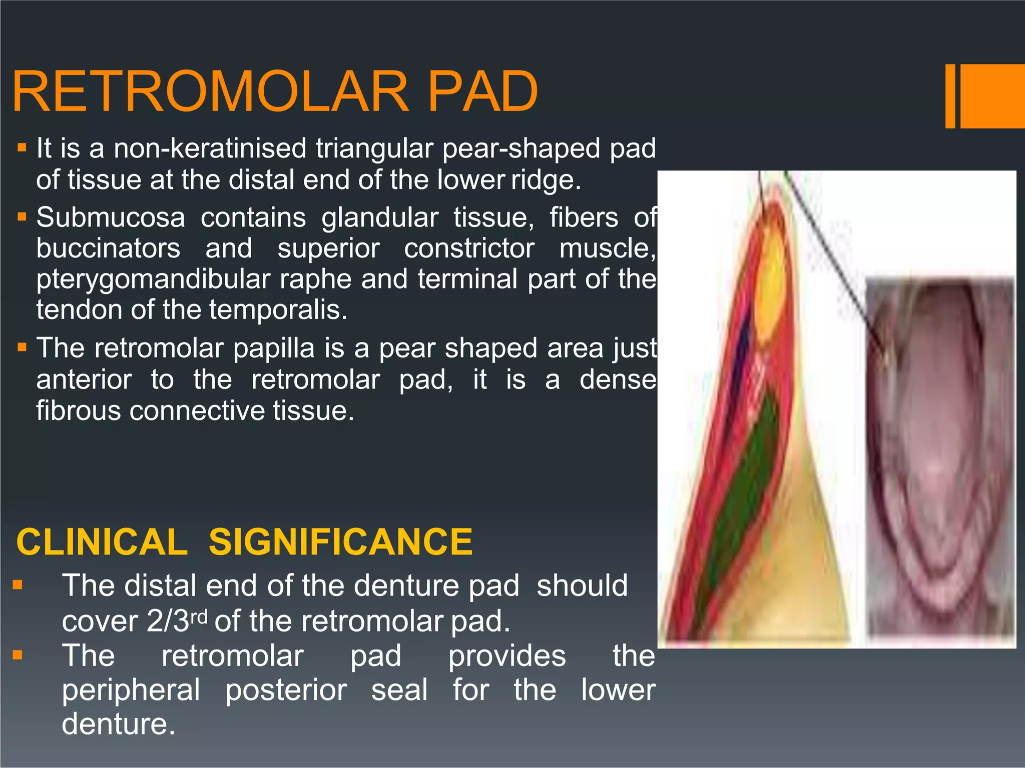 anatomyandclinicalsignificanceofdenturebearingareas-160731195726 ...