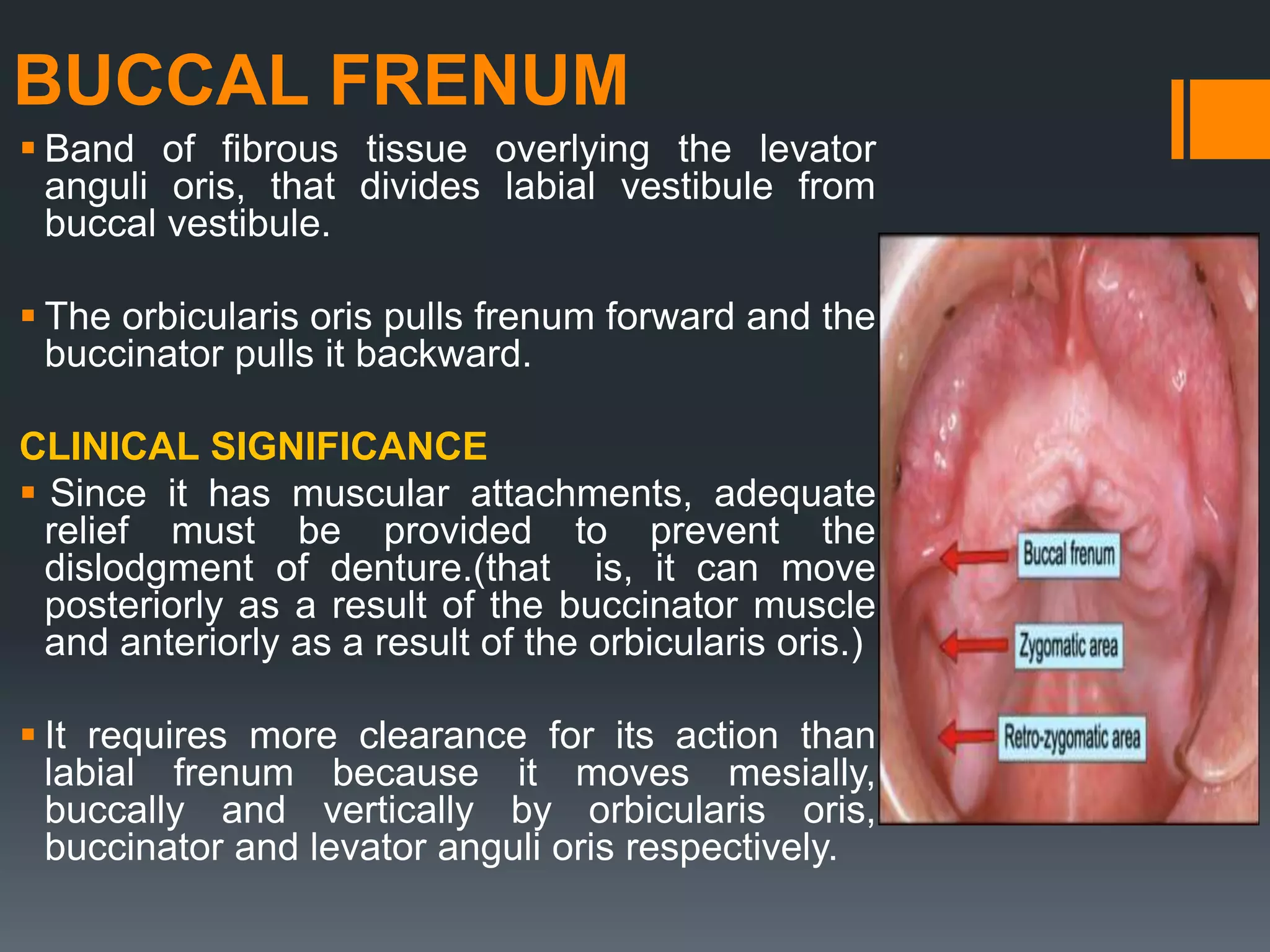 Anatomy and clinical significance of denture bearing areas | PPTX
