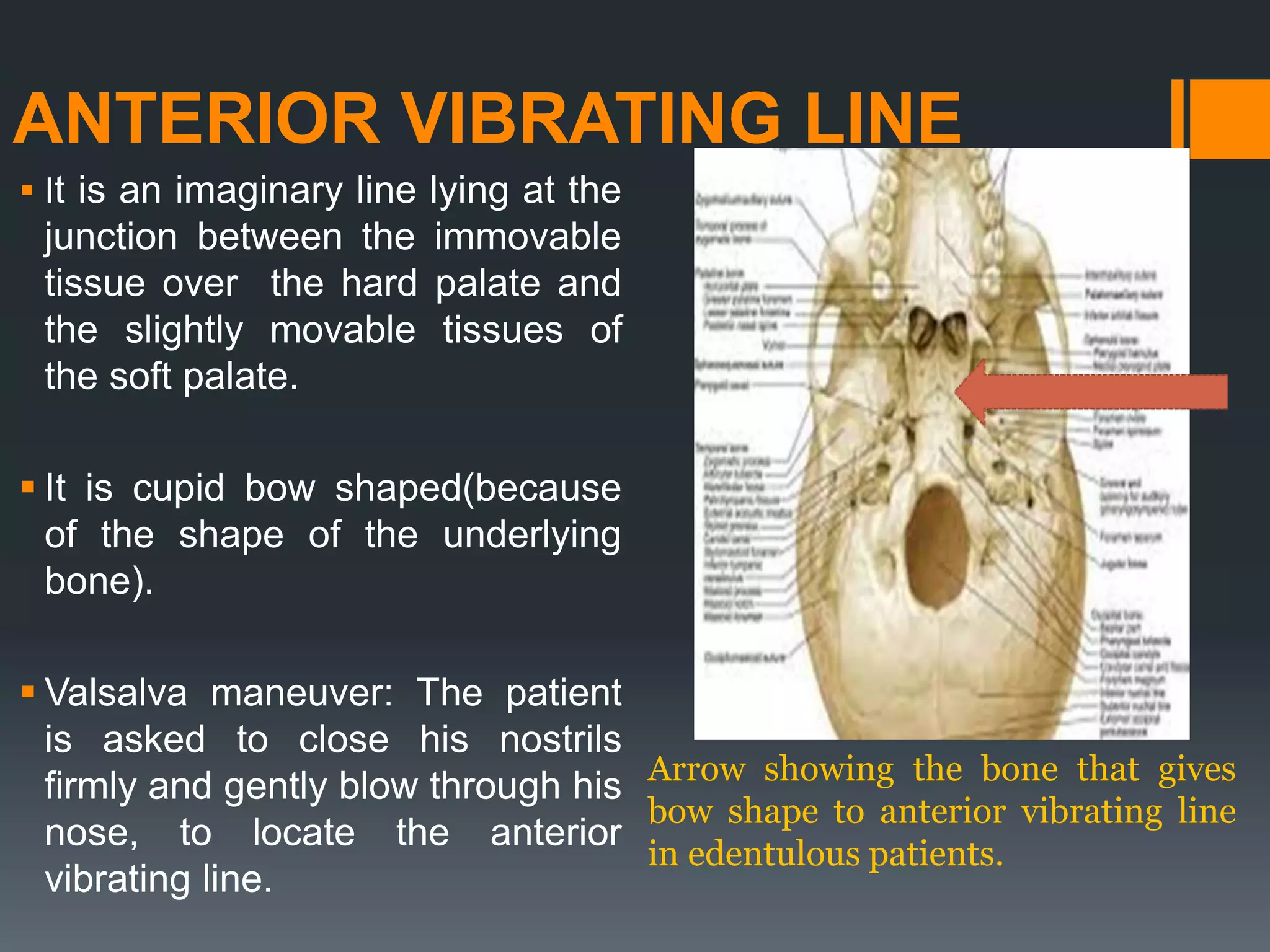 Anatomy and clinical significance of denture bearing areas | PPTX