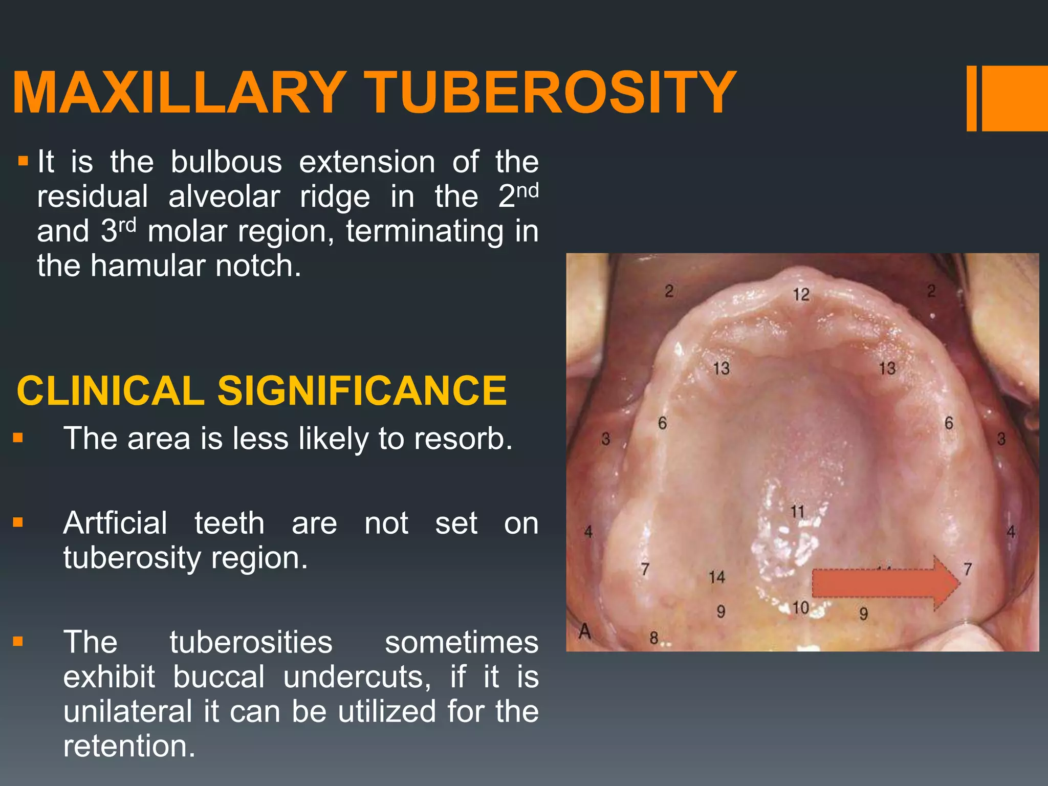 Anatomy and clinical significance of denture bearing areas | PPTX