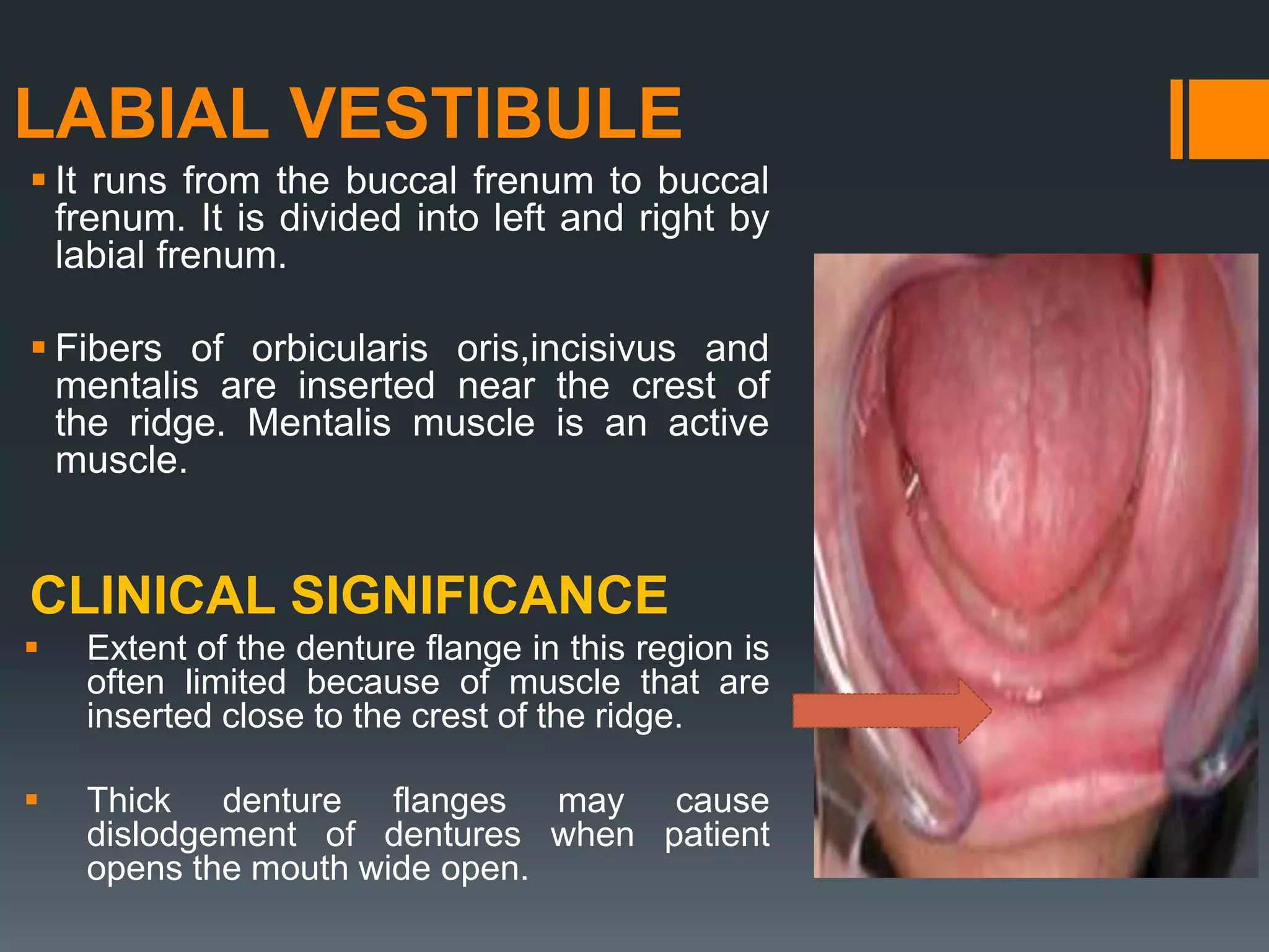 Anatomy and clinical significance of denture bearing areas | PPTX