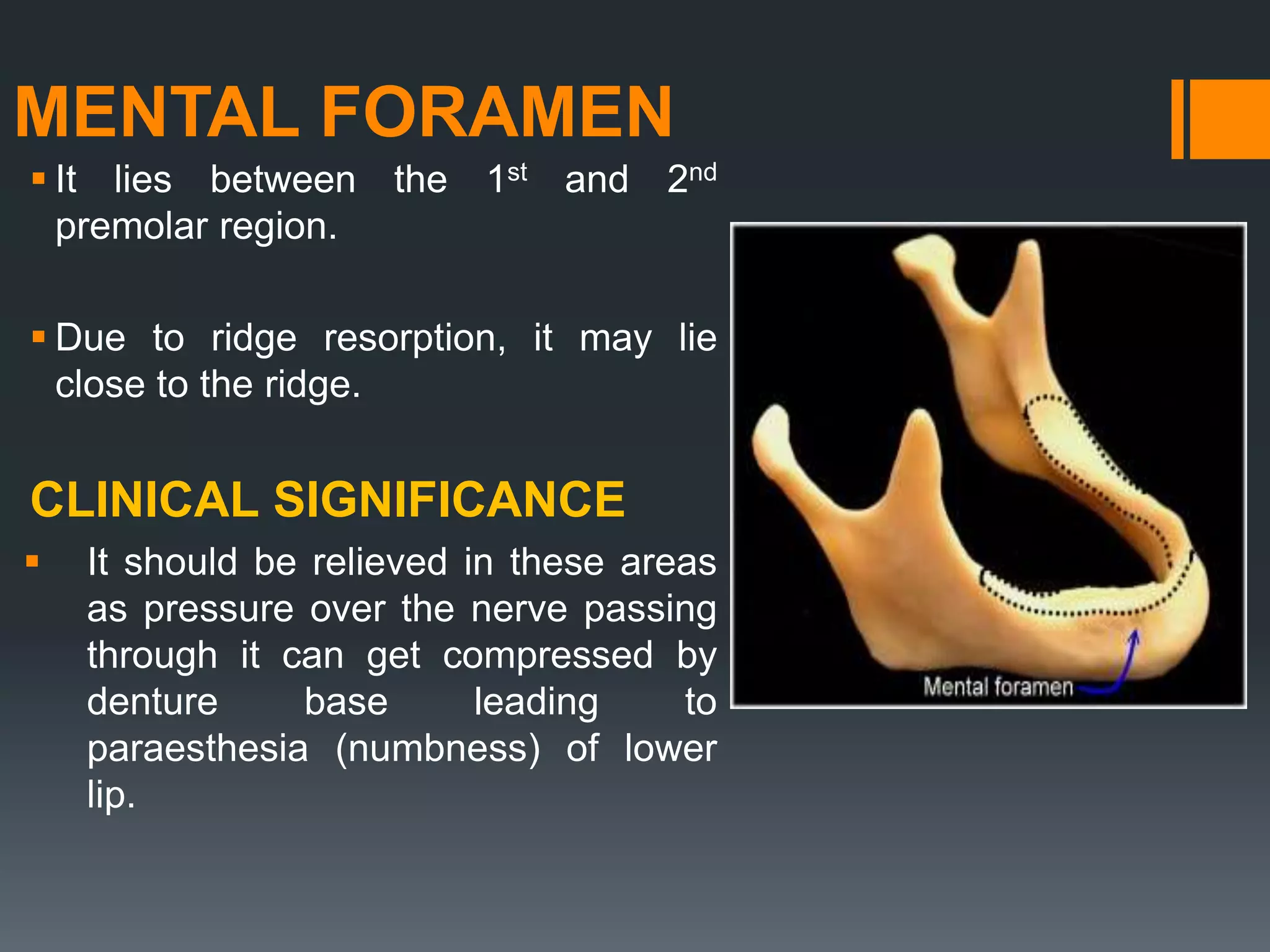 Anatomy and clinical significance of denture bearing areas | PPTX