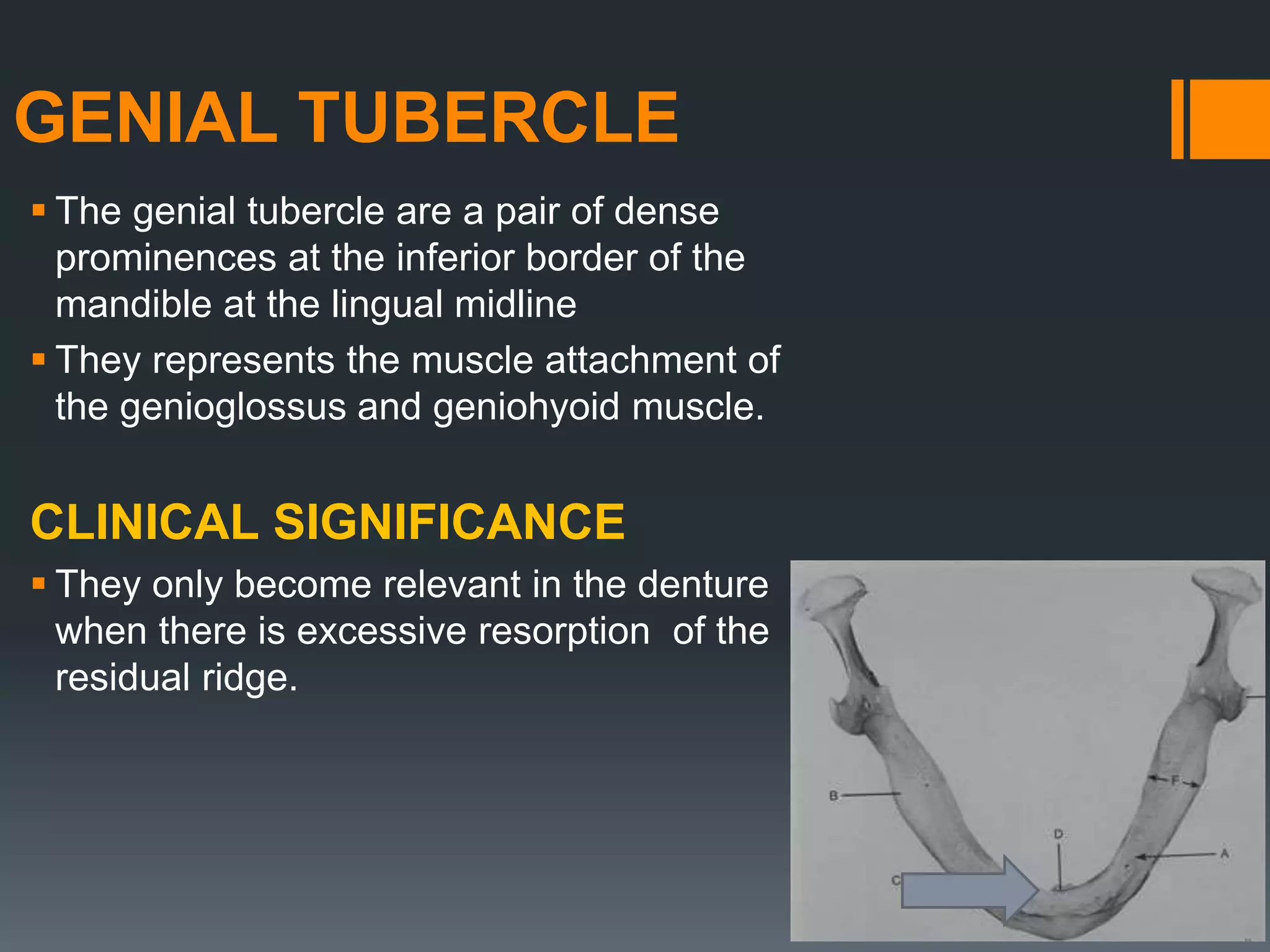 Anatomy and clinical significance of denture bearing areas | PPTX