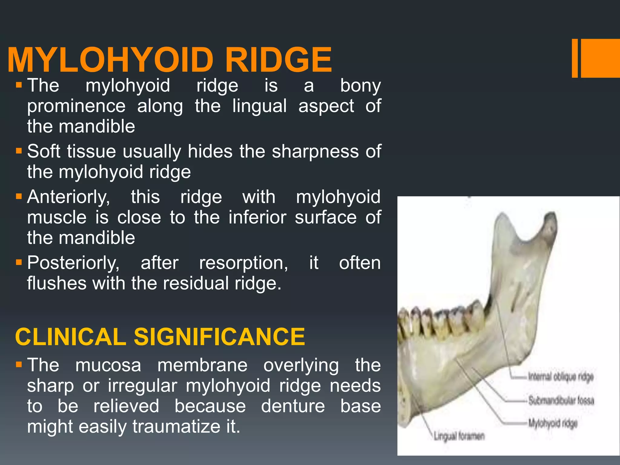 Anatomy and clinical significance of denture bearing areas | PPTX