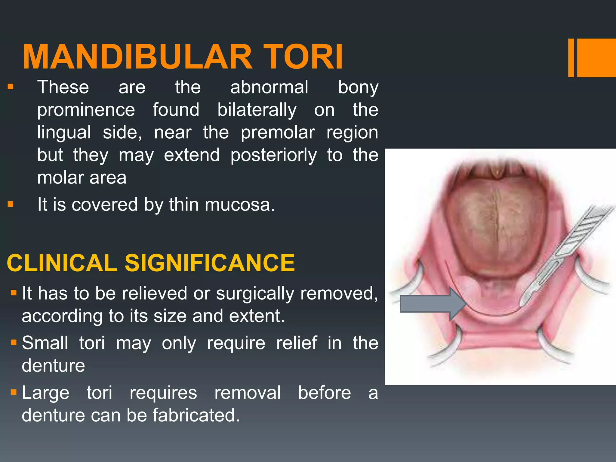 Anatomy and clinical significance of denture bearing areas | PPTX