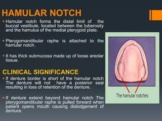 Anatomy and clinical significance of denture bearing areas | PPTX