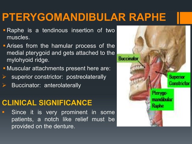 Anatomy and clinical significance of denture bearing areas | PPTX ...