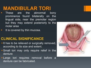 Anatomy and clinical significance of denture bearing areas | PPTX