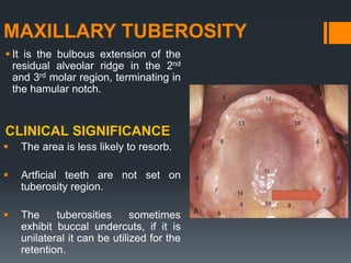 Maxillary Tuberosity Anatomy