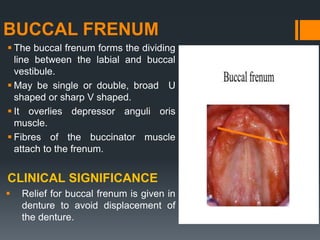 Buccal Frenum