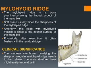 Mylohyoid Ridge Denture