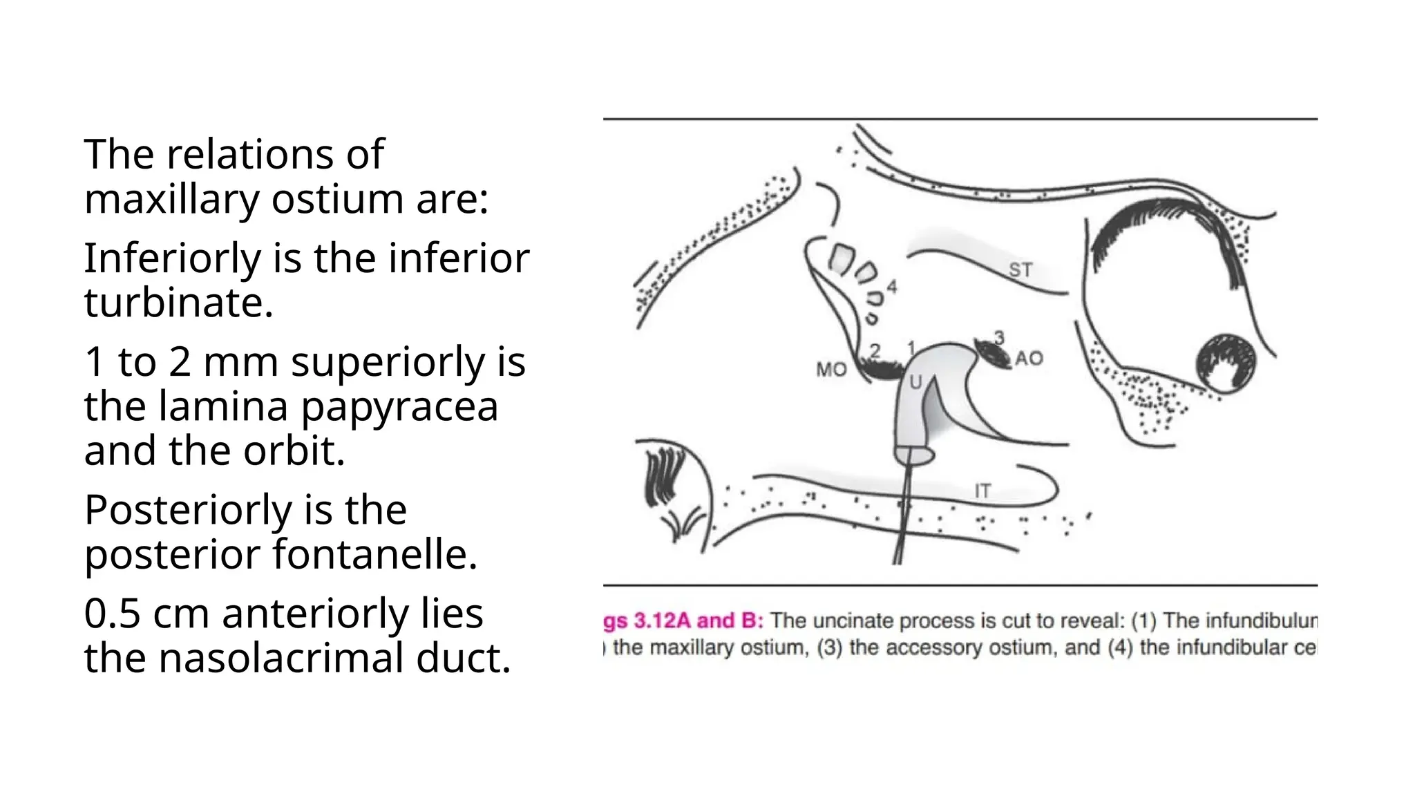 ANATOMY AND DEVELOPMENT OF PARANASAL SINUSES 2.pptx