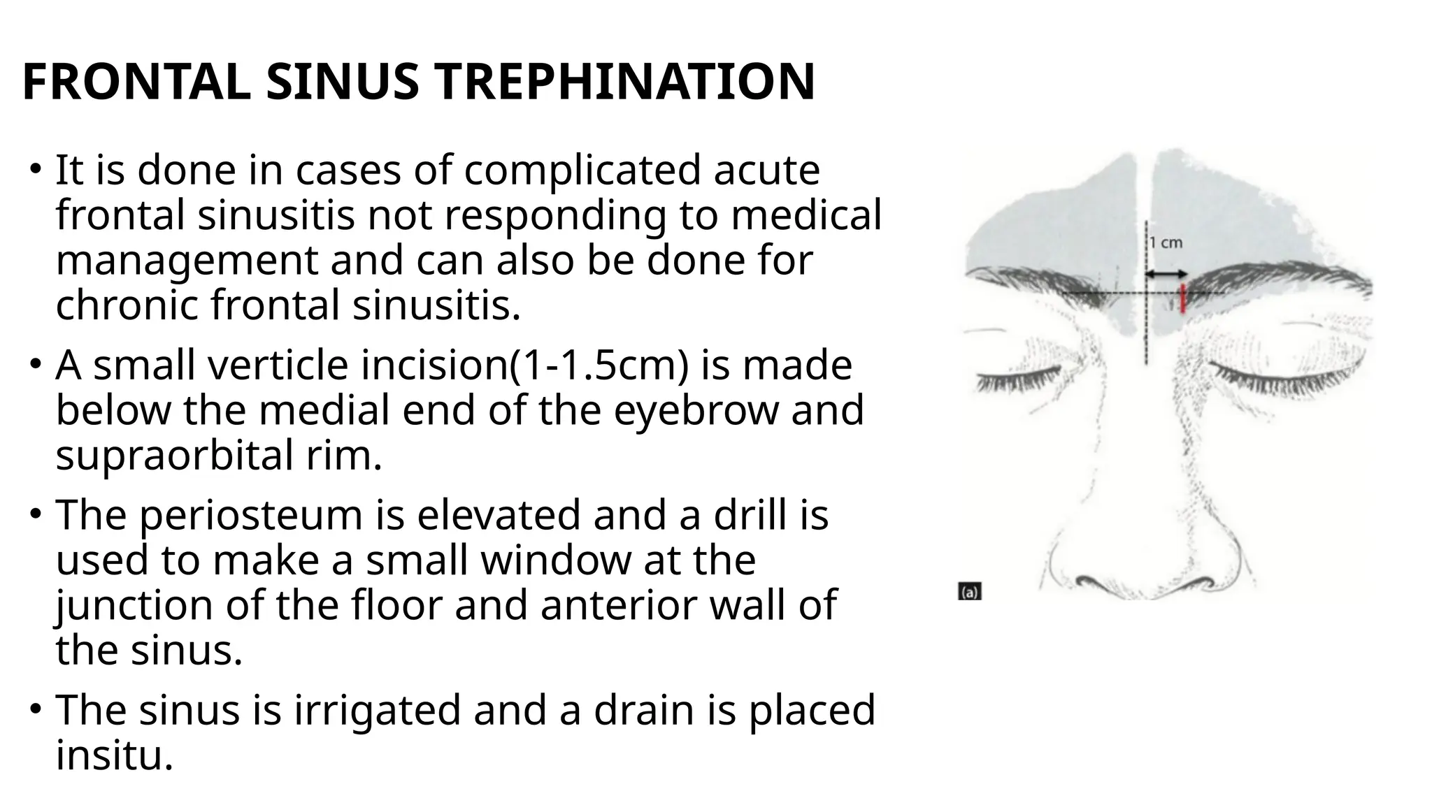 ANATOMY AND DEVELOPMENT OF PARANASAL SINUSES 2.pptx