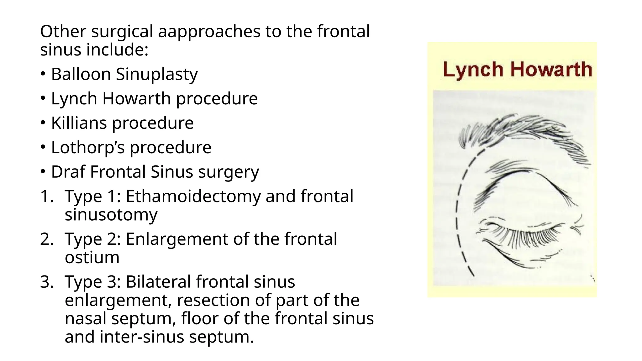 ANATOMY AND DEVELOPMENT OF PARANASAL SINUSES 2.pptx