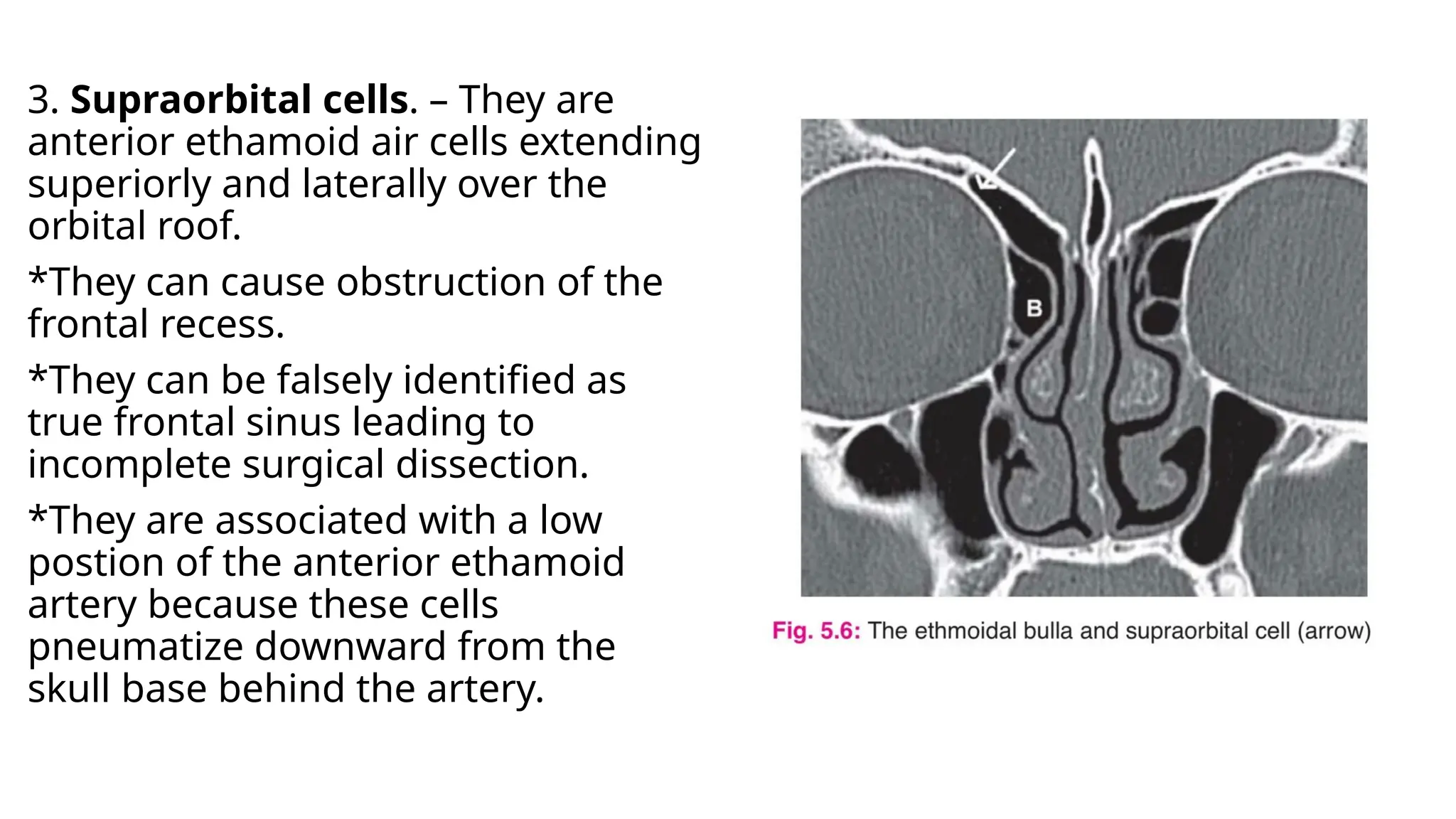ANATOMY AND DEVELOPMENT OF PARANASAL SINUSES 2.pptx