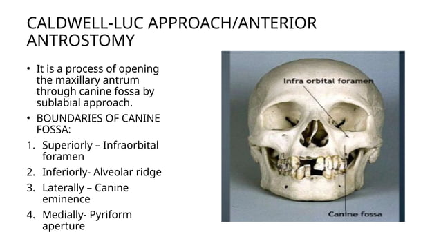ANATOMY AND DEVELOPMENT OF PARANASAL SINUSES 2.pptx